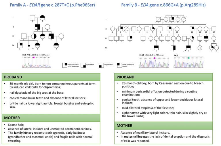 Mutations in EDA and EDAR genes cause dominant syndromic tooth agenesis ...