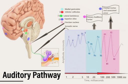 The Auditory Afferent Pathway as a Clinical Marker of Alzheimer's ...