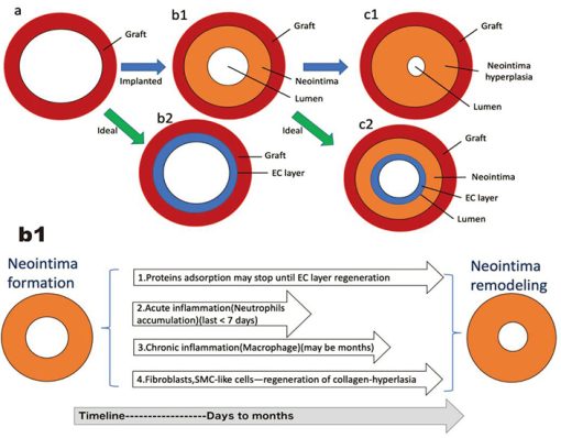A proteomics analysis of neointima formation on decellularized vascular ...